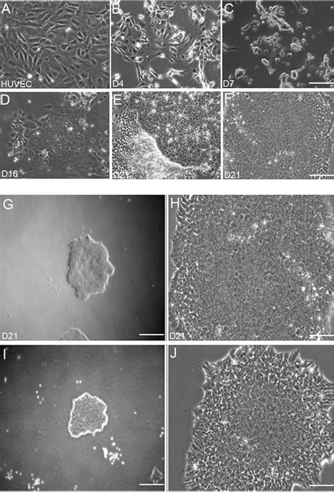 Feeder Layer Independent Induced Pluripotent Stem Cells Generation From