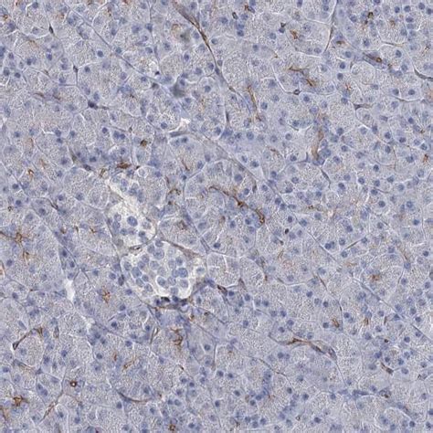 Anti Synaptopodinsynpo Mouse Monoclonal G1d4 Lyophilized Purified