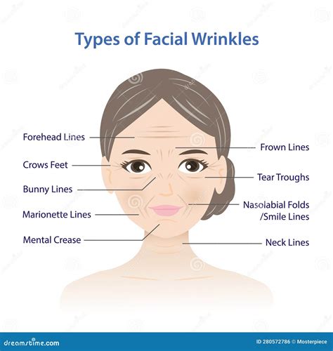 Types Of Facial Wrinkles On Woman Face Vector Illustration Isolated On White Background