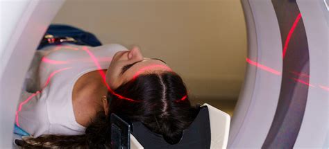 Oncology Stereotactic Radio Surgery Upmc Ireland
