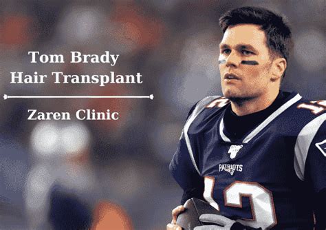 Tom Brady Hair Transplant Zaren Clinic