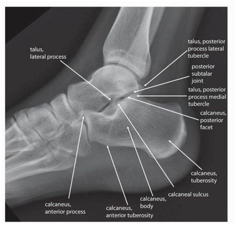 Diagnostic Imaging Techniques Of The Foot And Ankle Musculoskeletal Key