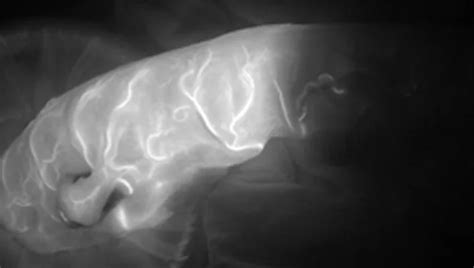 Spy Phi Fluorescence Imaging Stryker