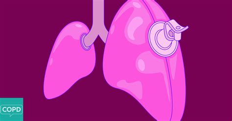 Hyperinflated Lungs And Copd
