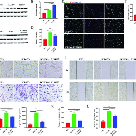 Sci Evs Promoted Proliferation And Function Of Endothelial Cells In