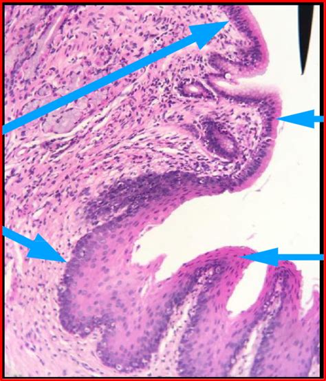 Gastroesophageal Junction Histology Diagram Quizlet