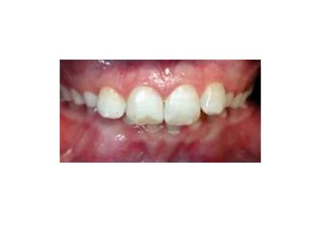 Orthodontic Terminologies Pptx