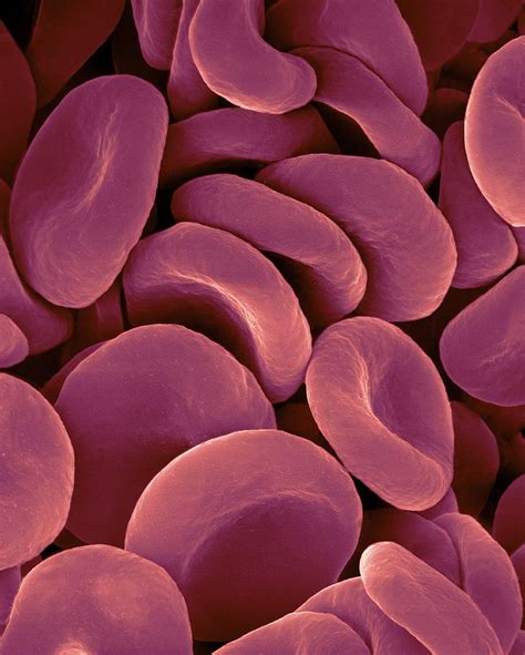 Electron Microscope Red Blood Cells Under Microscope Micropedia My