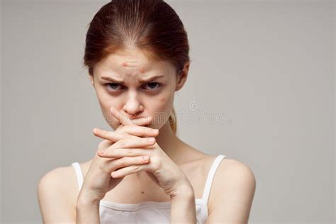 Beautiful Woman Facial Skin Problems Dermatology Isolated Background