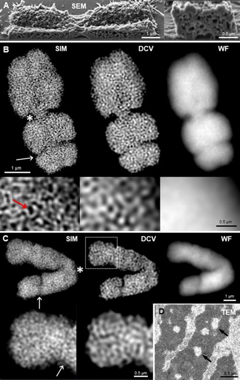 Mitotic Chromosome Organization General Rules Meet Species Specific Variability Computational