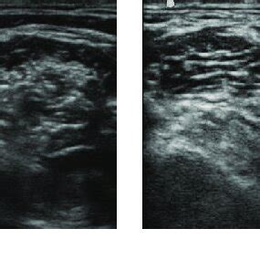 Example Of An Enhanced Image Using Limiting Contrast Adaptive Histogram