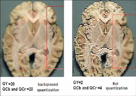Effect Of Lossy And Quasi Lossless Quantization Download Scientific