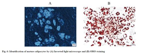 Establishment Of Co Culture Model Of Primary Mature Adipocytes And