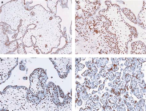 Dna Methylation In Normal And Molar Placenta Tissue Normal And