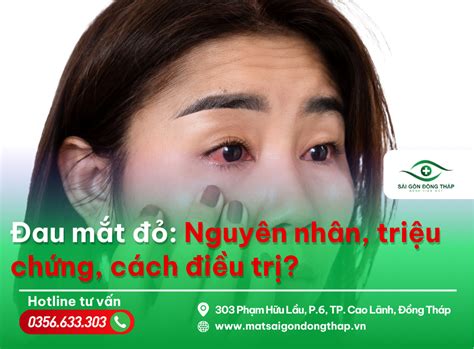 Nhìn Vào Mắt Của Người đau Mắt đỏ Có Lây Không Bệnh Viện Mắt Sài Gòn Đồng Tháp