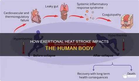 How Exertional Heat Stroke Impacts The Human Body Medshun