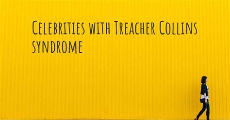 Celebrities With Treacher Collins Syndrome