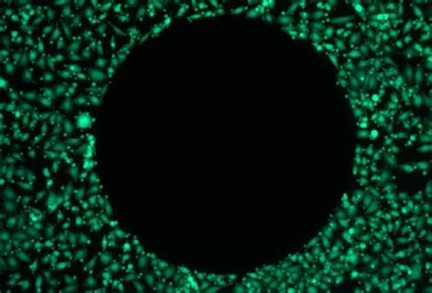 Cell Migration Assay Kit Cell Invasion Assay Kit 고마바이오텍