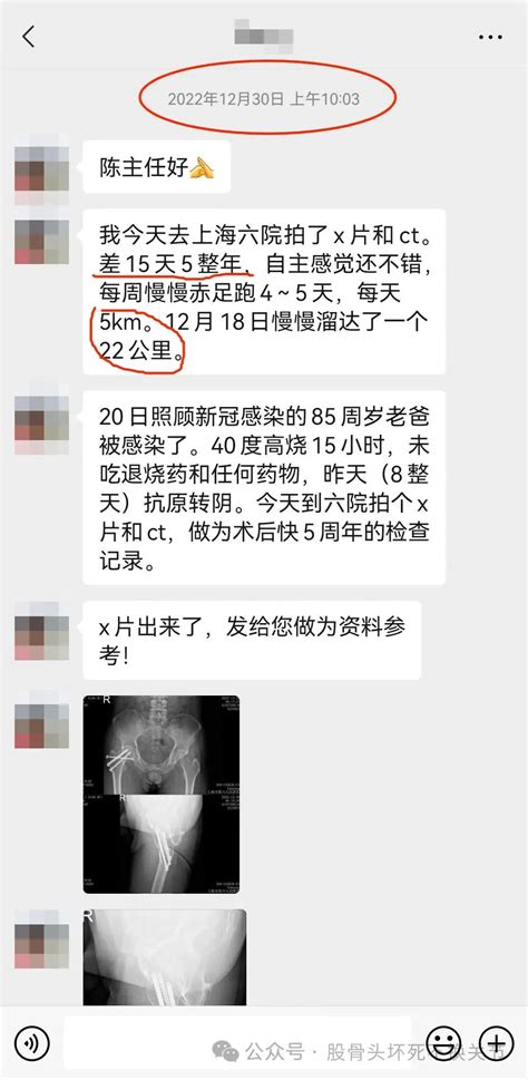 股骨颈骨折 “31”根钉，画蛇添足还是亡羊补牢？ 好医术文章 好医术 赋能医生守护生命