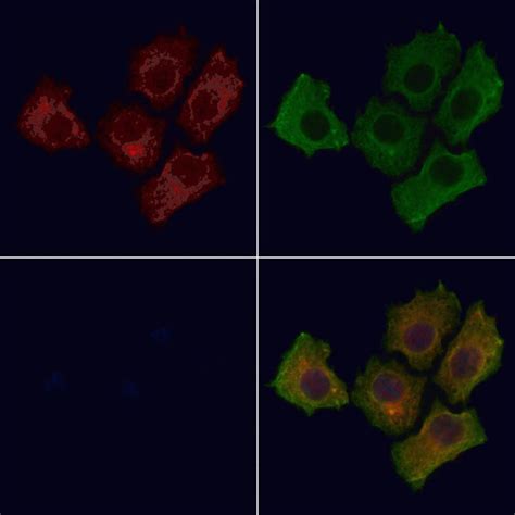 Phospho Egfr Tyr1197 Polyclonal Antibody Pa5 104723