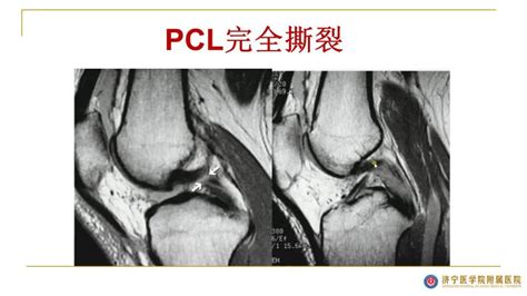 Mri Medsci Cn