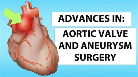 Aortic Root Dilation