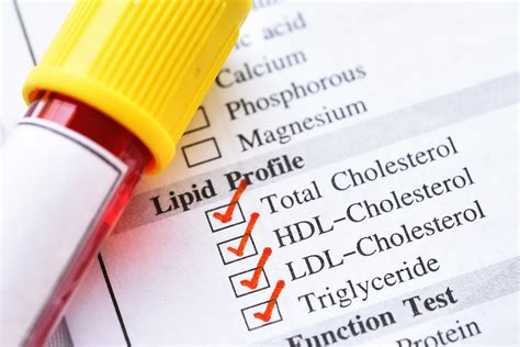 High Triglyceride Levels Symptoms Causes Tests Range