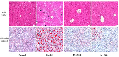 Representative Photos Of Haematoxylin And Eosin Hande Staining Top