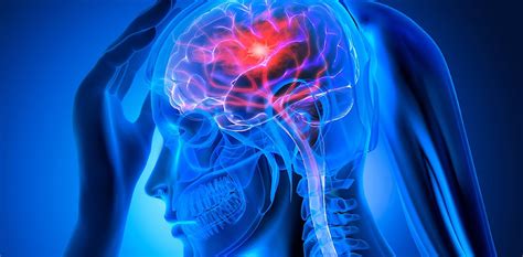 Conferenza Pubblica “aneurisma Cerebrale Cosè E Come Si Cura Posti Esauriti Swiss Medical