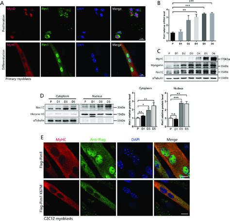 Pim1 Kinase Is Upregulated And Translocated From Cytoplasm Into Nucleus