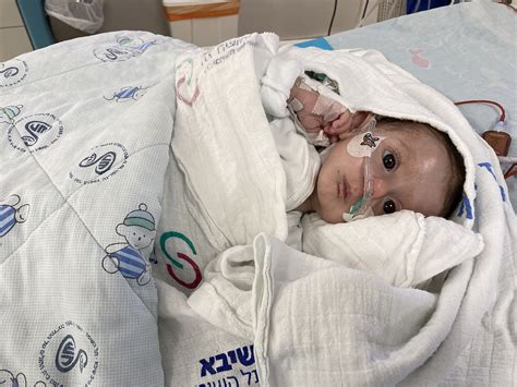 Extubated