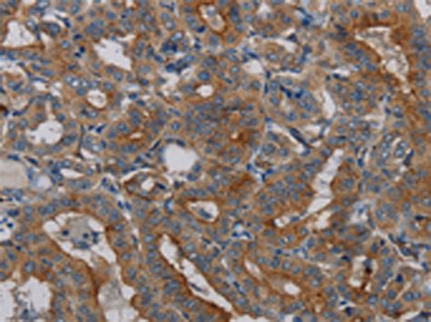 兔抗PER2多克隆抗体 Anti PER2 rabbit polyclonal antibody 生命科学产品与技术服务 生工生物工程 上海 股份有限公司