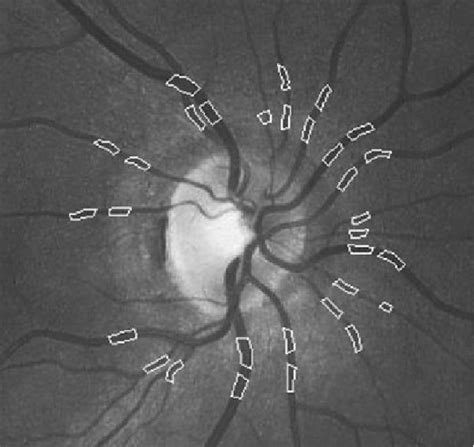 Results Of The Segmentation Process In Two Different Radii Each Download Scientific Diagram