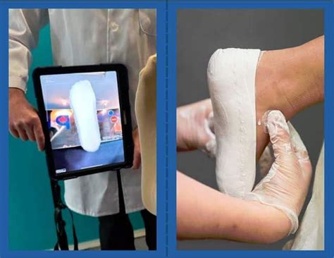 Virtual Casting For Podiatry And Orthotics Sean Cornwell Posted On The Topic Linkedin