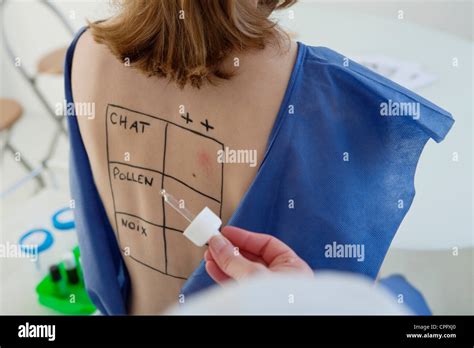 Allergy Test Woman Stock Photo Alamy