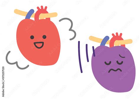健康な心臓と不健康な心臓のイラスト Stock ベクター Adobe Stock