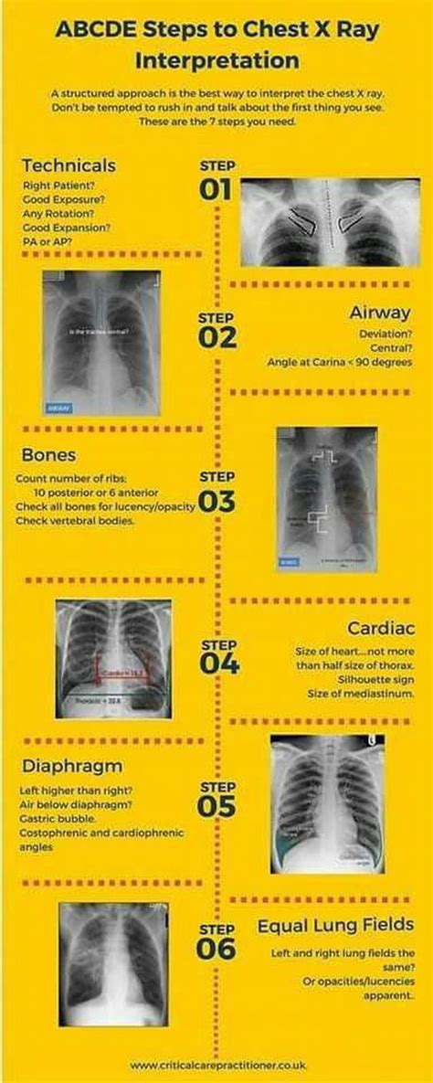 Cxr Interpretation Medizzy