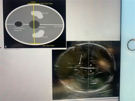 Chapter Assessment Of Fetal Age And Size In The Nd And Rd
