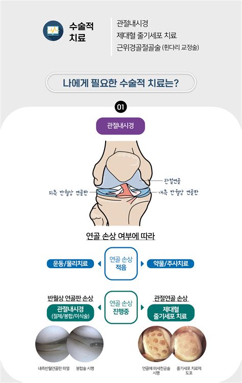 나에게 맞는 치료법은 21건강정보