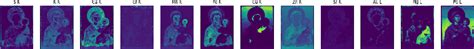 Figure 52 From Deep Learning Methods For Elemental Map Prediction From