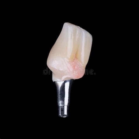 Two Dental Crowns With Artificial Gum Made Of Zirconium On Titanium