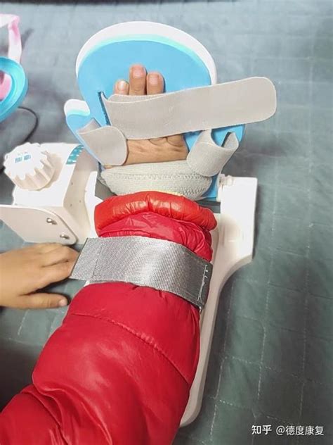 手腕康复的训练方法 知乎
