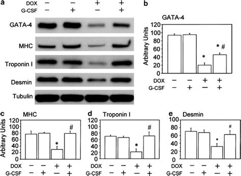 Granulocyte Colony Stimulating Factor Improves Left Ventricular Function Of Doxorubicin Induced