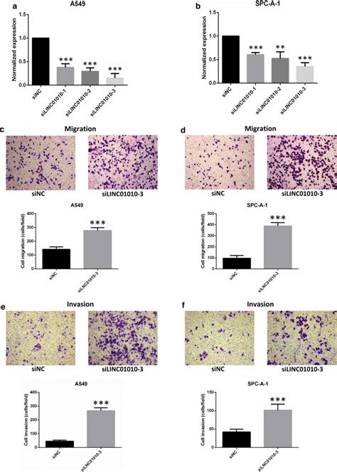 Linc01010 Represses Lung Cancer Cell Migration Linc01010 Expression