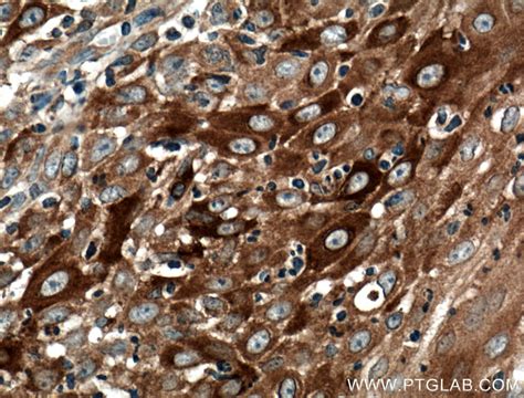 Ifit Antibody Ap Proteintech