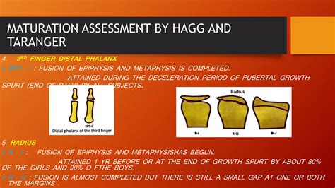 skeletal maturity indicators pptx