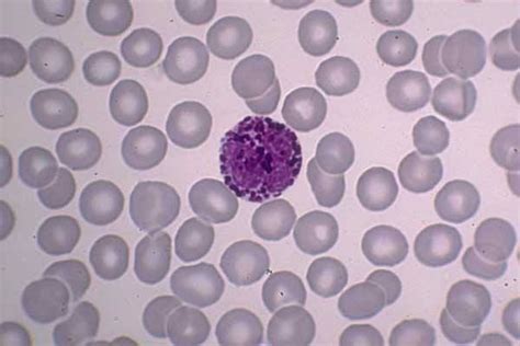 Basophil Medical Information Pathology