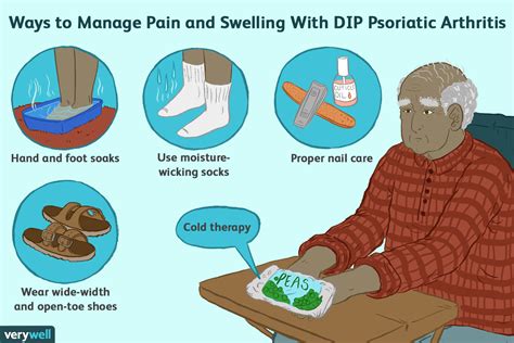 Dip Joint Arthritis Orthobullets At Jenenge Blog