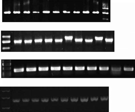 Amplification Of The Dna Barcoding Candidate Genes Of A Anomala A