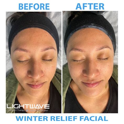 Lightwave Therapy LED Light Therapy Topical Light Infusion
